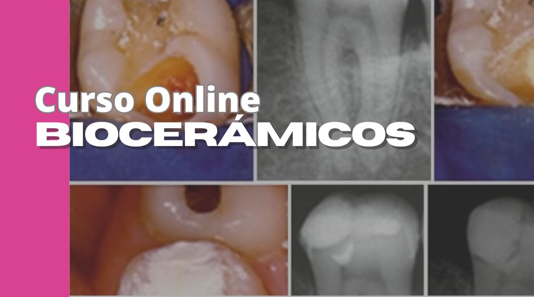 Biocerámicos | ICS - Instituto Caride Sierra