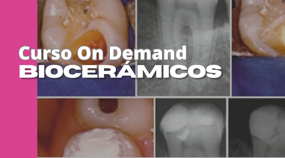 Biocerámicos | ICS - Instituto Caride Sierra